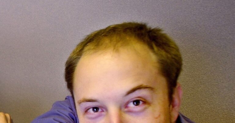 Male celebrities before and after plastic surgery procedures: PHOTOS ...